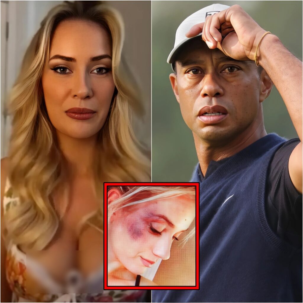 SAD NEWS🔴 Tiger Woods and golf fans shed tears and pray for Paige ...